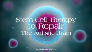 Stem Cell Therapy To Heal the Autistic Brain - World Stem Cells Clinic